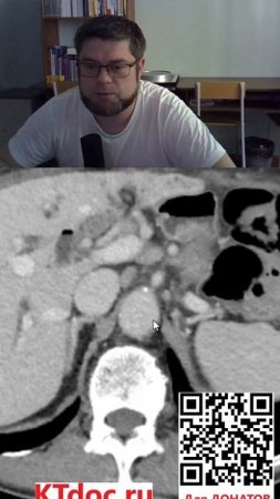 Расшифровка КТ и МРТ #mentor #ct #кт #наставник #ктдок
#мрт #mri #mentor #наставник  #ktdoc #ктдок