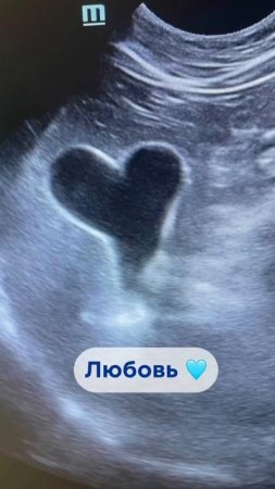 Что никогда не выйдет из моды? #ветеринар #любовь #живо?