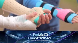Гипс XXI века, подборка гаджетов для походов и тайна рыжих котов | «Чудо техники»