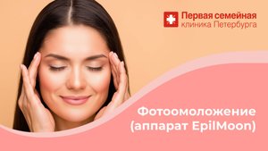 Фотоомоложение (аппарат EpilMoon)