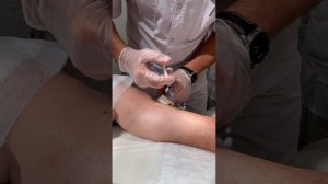 Процедура Внутримышечного введения препарата "Неоваскулоген"