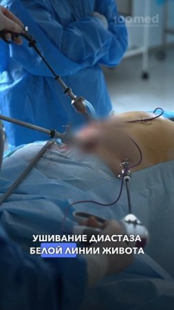 Операция Грыжи Без Разрезов! Почему 90% Пациентов Выбирают Лапароскопию?