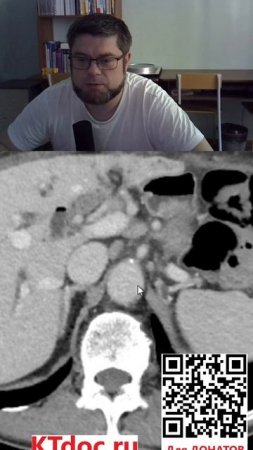 Расшифровка КТ и МРТ #mentor #ct #кт #наставник #ктдок #мрт #mri #mentor #наставник  #ktdoc #ктдок