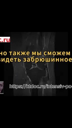 Хочешь за 1 день начать разбираться в МРТ?