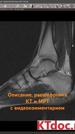 Описание и расшифровка КТ и МРТ