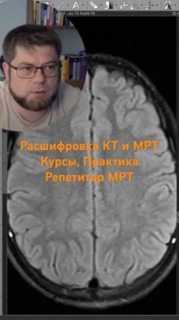 Репетитор МРТ