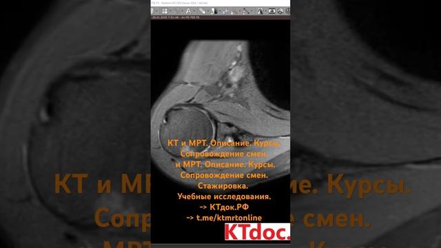 Описание МРТ
