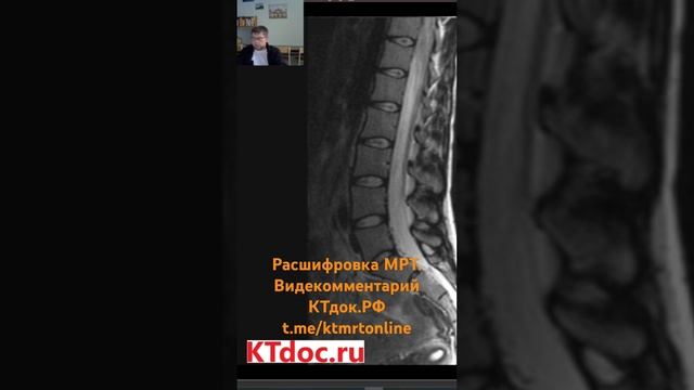 Расшифровка МРТ + видеокомментарий