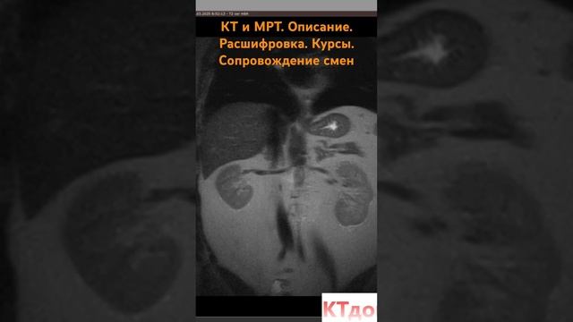 Расшифровка МРТ брюшной полости