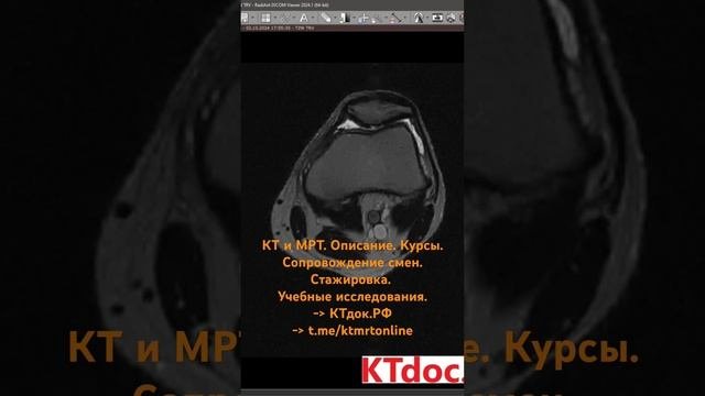 Видеокомментарий к вашему обследованию