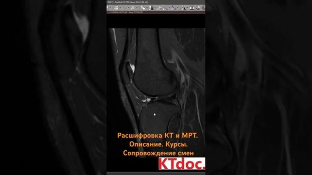 Расшифровка МРТ и КТ