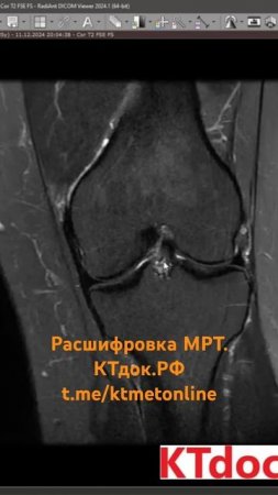 Расшифровка МРТ от КТдок.РФ