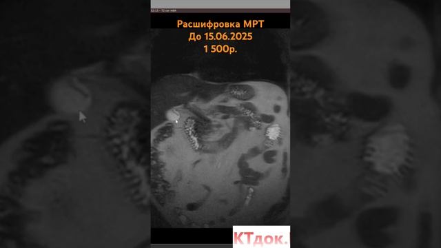 Расшифровка МРТ