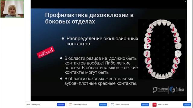 Финишинг на элайнерах