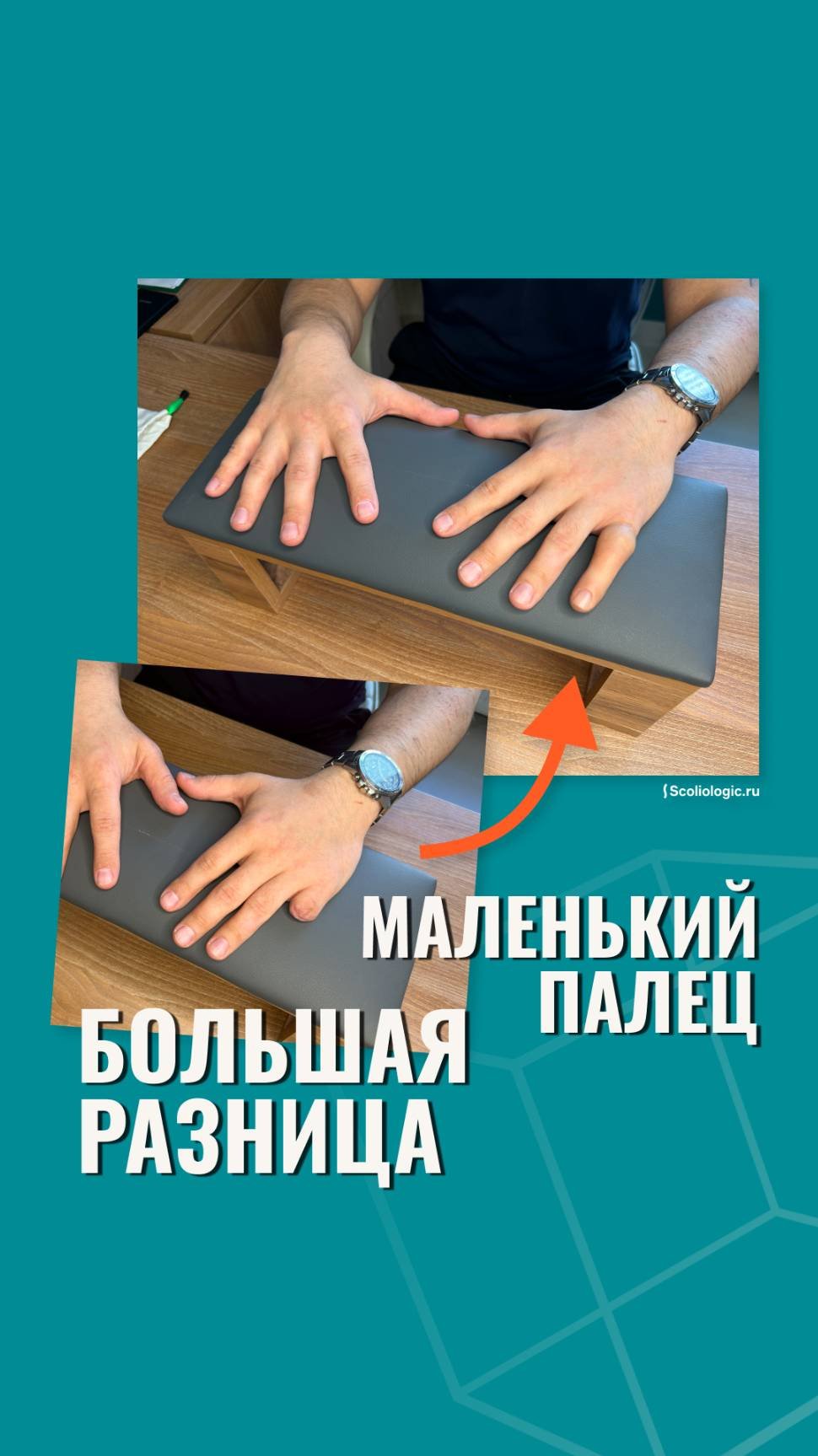 Маленький палец. Большая разница