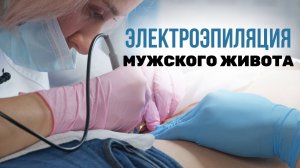 Урок №67. Мужская электроэпиляция ЖИВОТА. Без обезболивания!!!