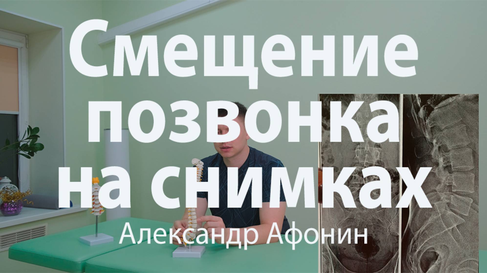 Смещение позвонков на рентгеновских снимках, чтобы вы могли оценить состояние позвоночника