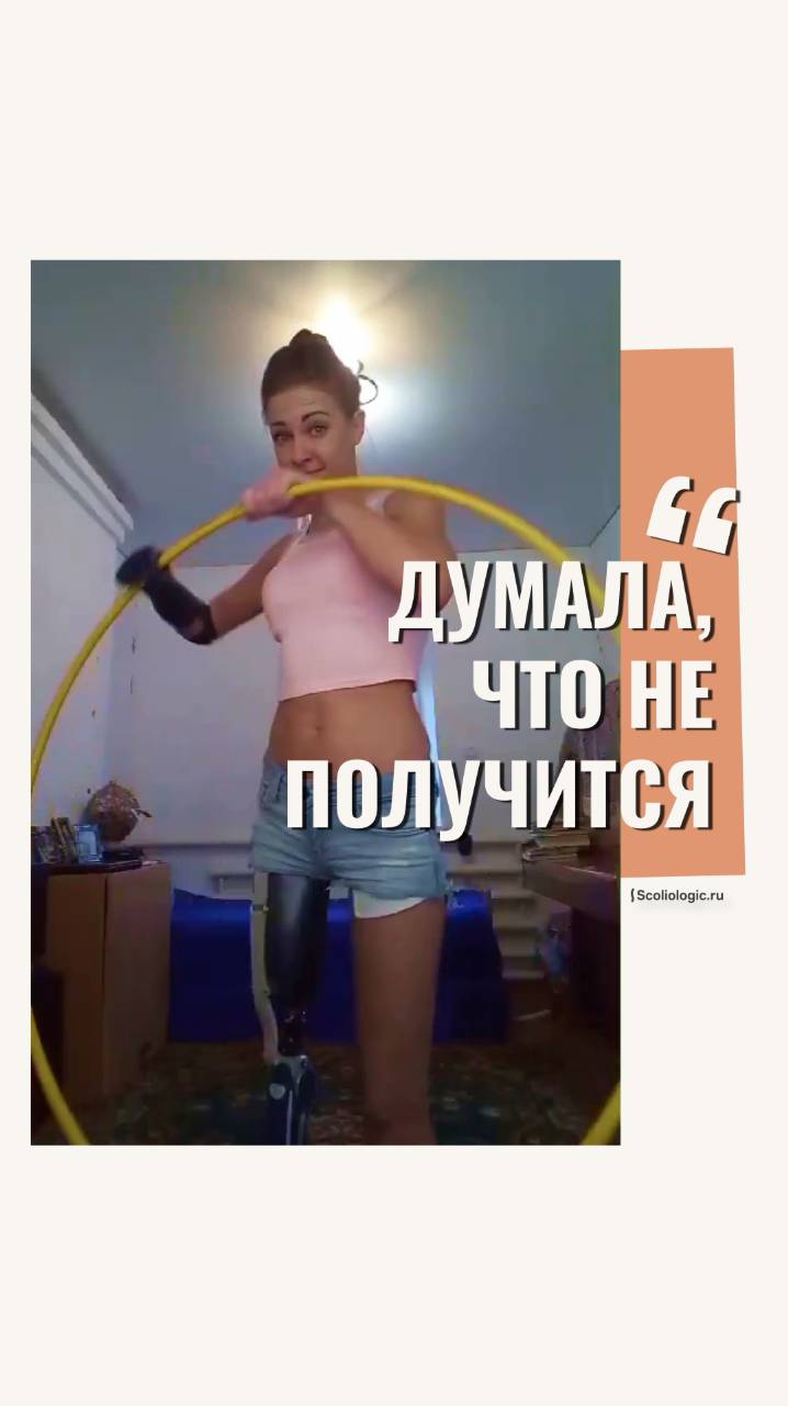 Девушка с протезом руки и протезом ноги. Счастлива!