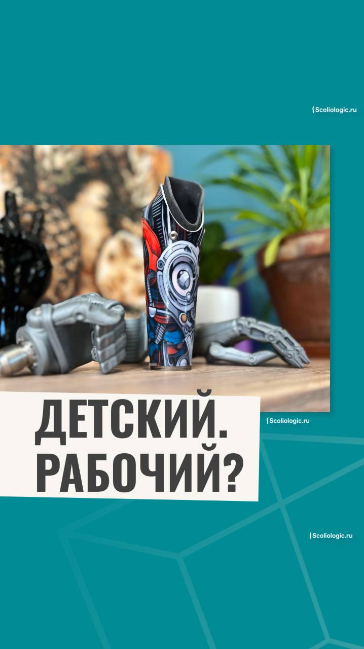 Детский протез руки для отжиманий