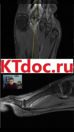 Келлер_2