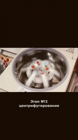 PRP-терапия – эффективная методика при травмах и дегенеративных изменениях суставов.