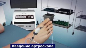 Артроскопия голеностопного сустава - показания к операции, как проходит, осложнения и реабилитация