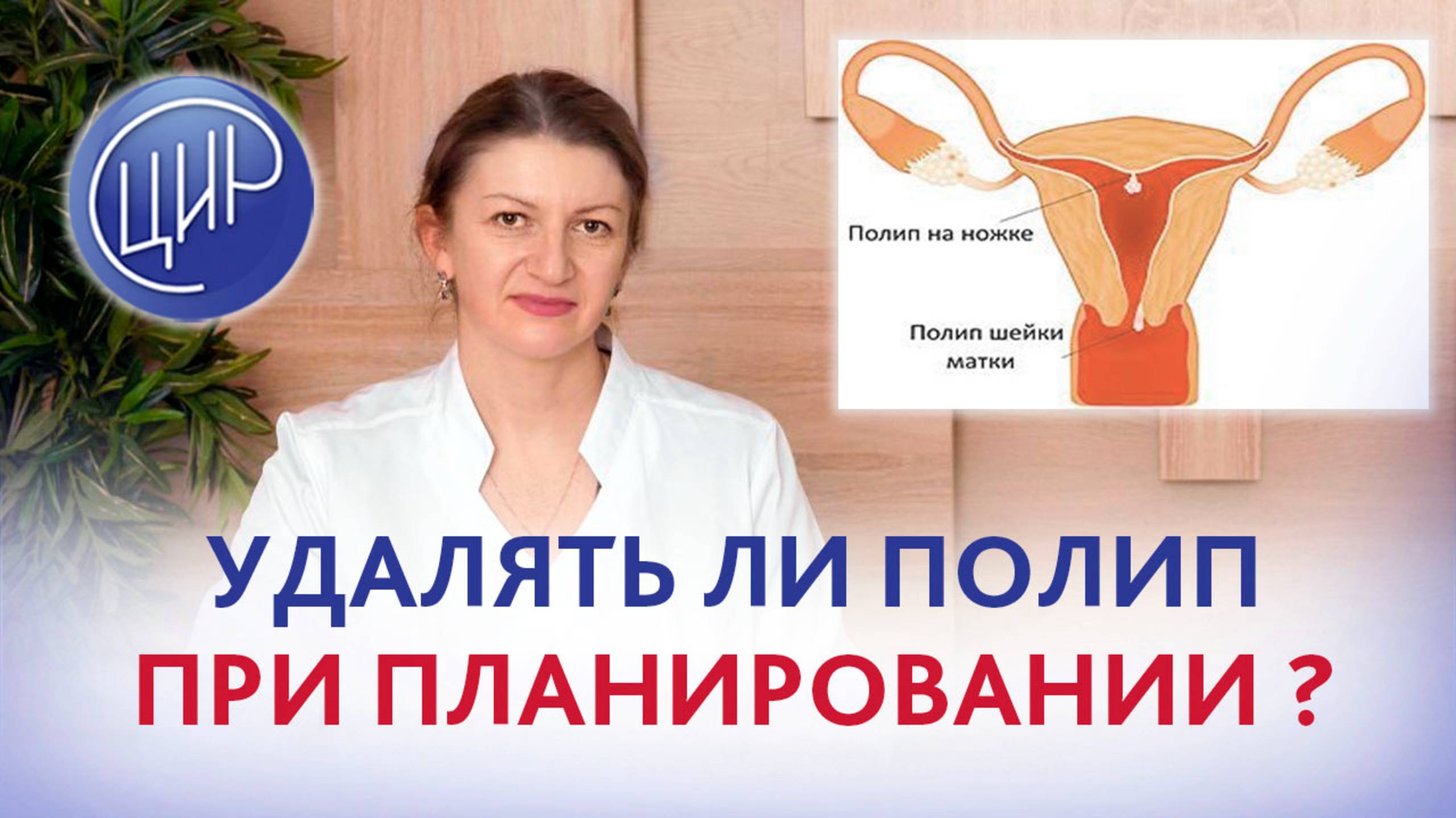 Полип в матке 10 мм. Надо ли удалять полип на ножке 10 мм. при планировании беременности?