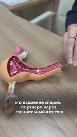 Внутриматочная инсеминация: подготовка, совместная работа врачей и эффективность