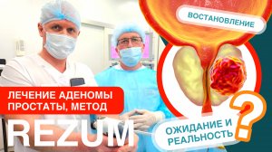 Чего ожидать после лечения аденомы предстательной железы с помощью Rezum-терапии?