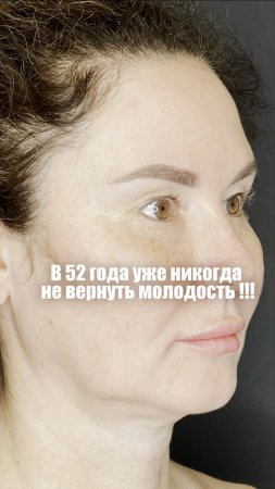 Возможно ли в 52 года вернуть молодость? Невидимая подтяжка лица  #сергейсвиридов