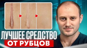 Рубцы НЕ ИСЧЕЗНУТ, если вы НЕ сделаете ЭТО! / Как удалить шрамы БЕЗ риска для кожи и здоровья?