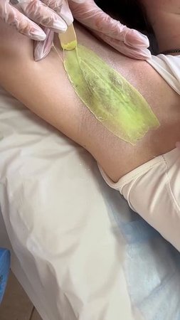 Депиляция подмышечных впадин воском