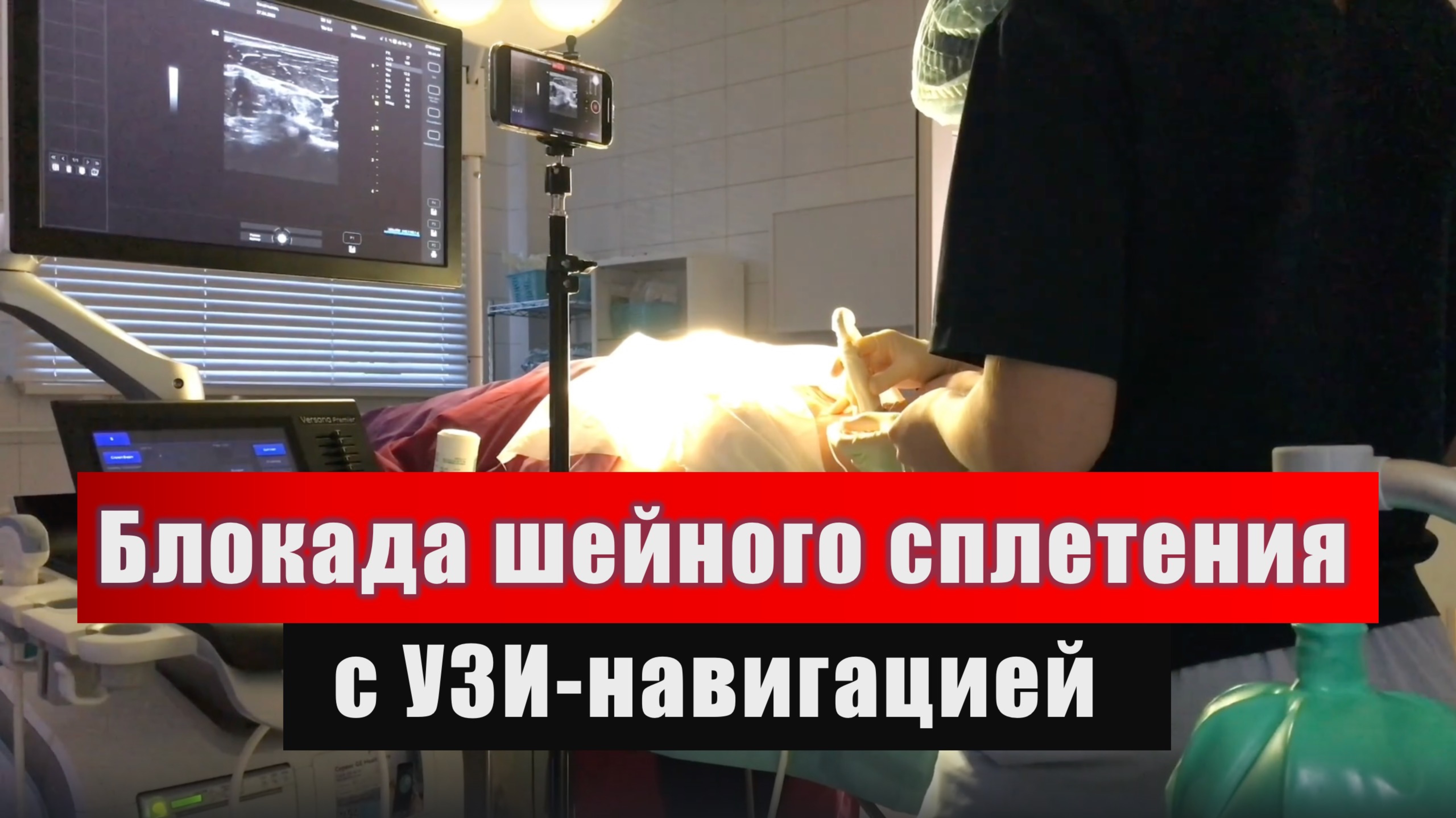 БЛОКАДА ШЕЙНОГО СПЛЕТЕНИЯ
#regionalanesthesia #узинавигация #регионарнаяанестезия #шейноесплетение