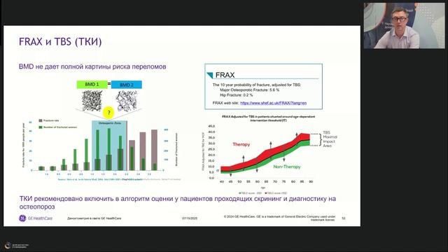 Денситометрия необходимые инструменты и знания для анализа
