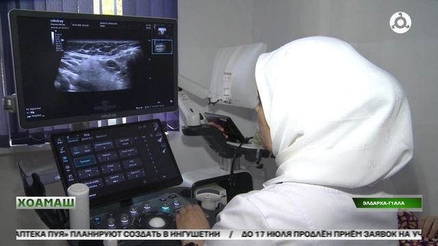УЗИ аппарат 1алашъяьй Элдарха г1алий т1арча дарбанче