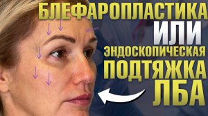 Блефаропластика или эндоскопическая подтяжка лба: что выбрать?/ Пластический хирург Сергей Свиридов
