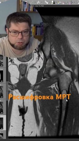 Расшифровка МРТ. Сопровождение на сменах молодых специалистов
