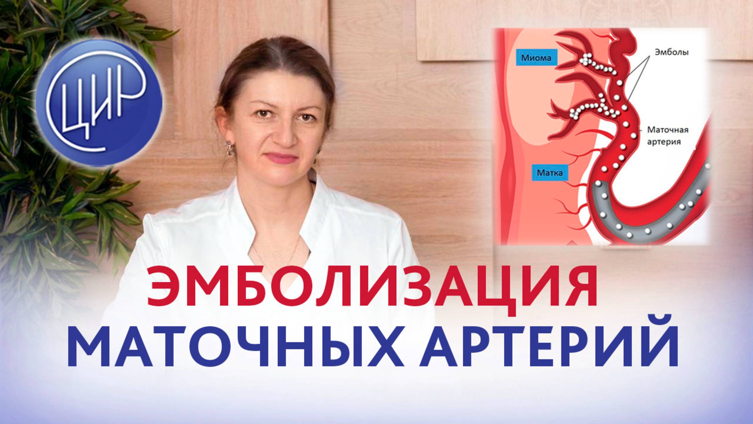 Эмболизация маточных артерий - это приговор? Дементьева Светлана Николаевна.