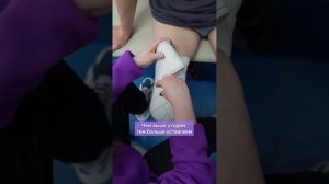 Бинтование культи  бедра