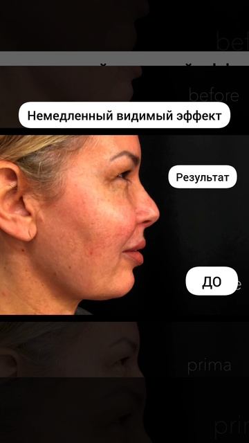 Результат