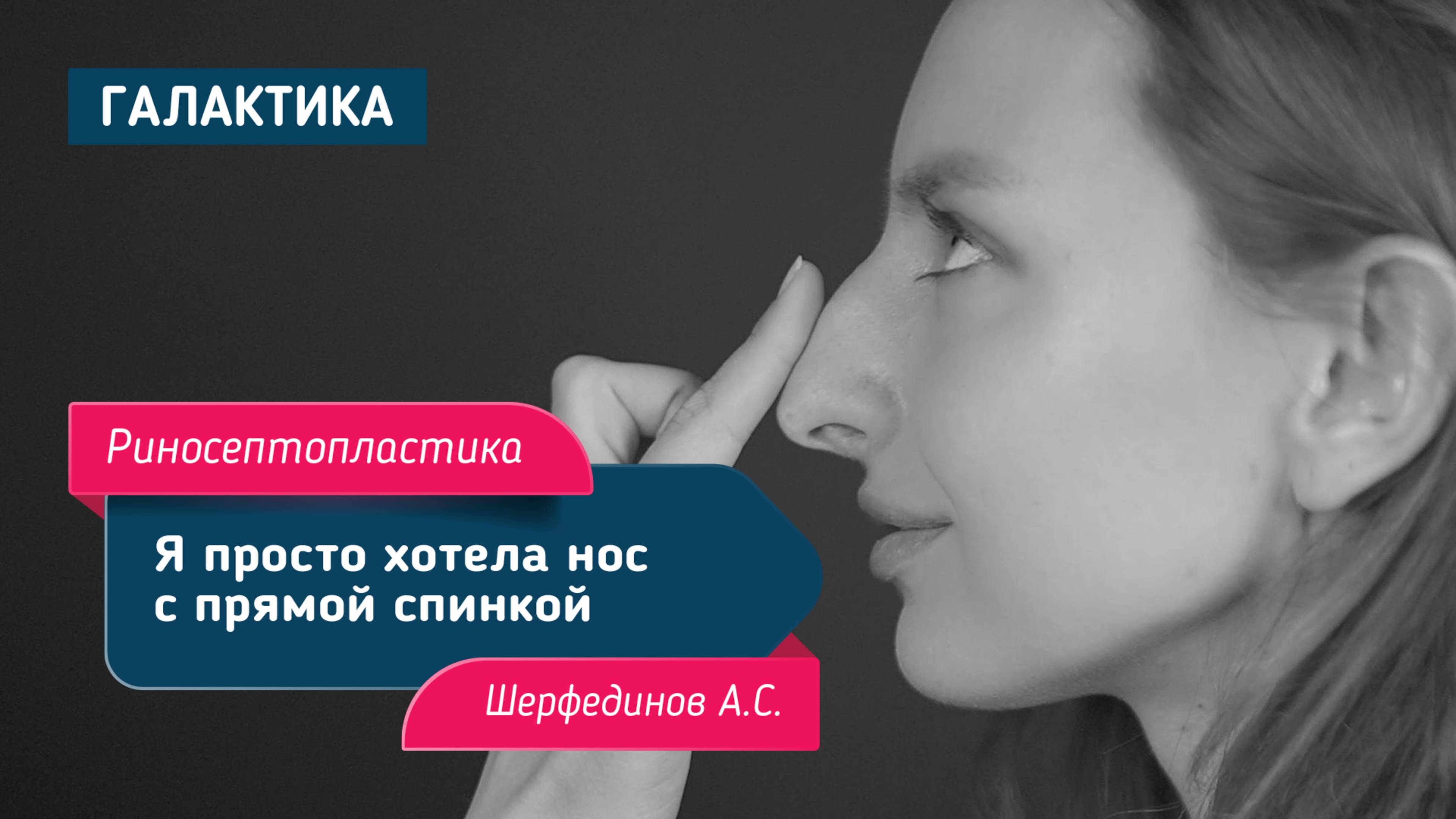 Риносептопластика у Дарьи | Хирург Шерфединов Арсений Сергеевич