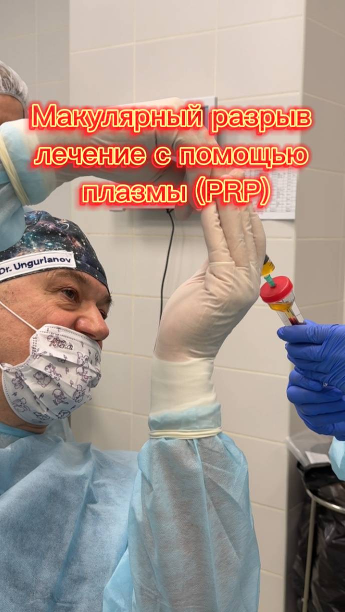 Лечение макулярного разрыва сетчатки глаза плазмой пациента. Зрение можно спасти.