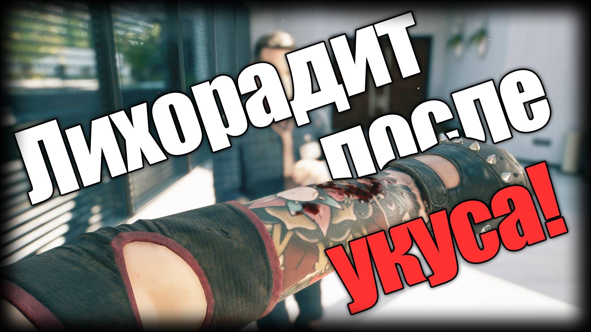 Dead Island 2 ► Лихорадит после укуса! ► | Ep.2 |