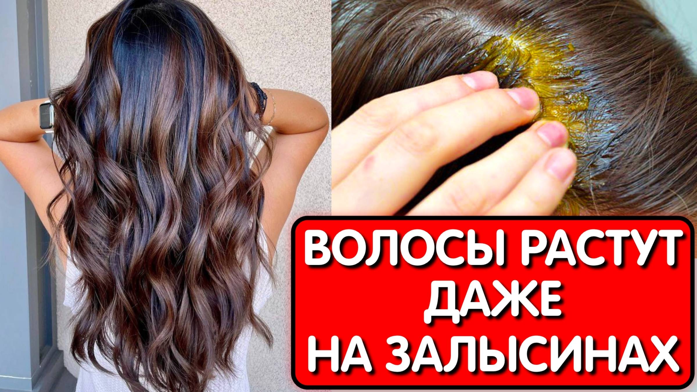 МОЙ СЕКРЕТ ОТ ВЫПАДЕНИЯ ВОЛОС - ЧАЙНЫЙ КОНЦЕНТРАТ ! Волосы растут даже на залысинах и ГУЩЕ В 3 РАЗА