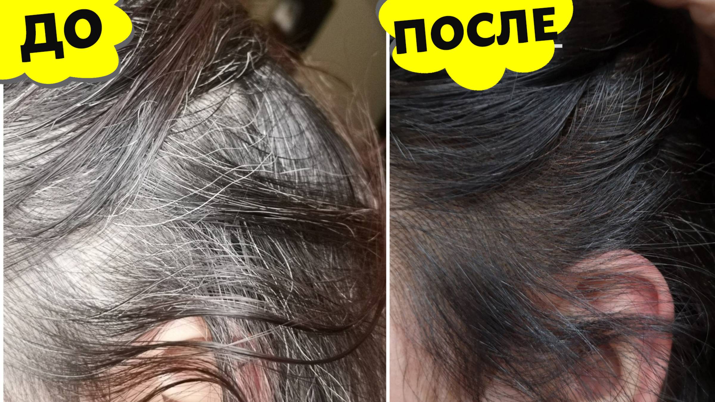 ЭТО Сильное СРЕДСТВО УБЕРЁТ СЕДЫЕ ВОЛОСЫ ОЧЕНЬ БЫСТРО! Без окрашивания / Все без ума от него!