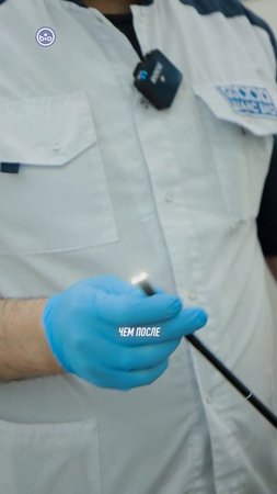 Эндоскоп