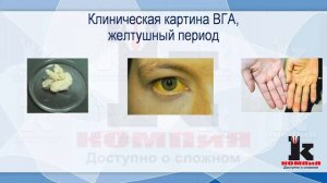9.1 Энтеральные вирусные гепатиты. Этиология, эпидемиология. Принципы клинической диагностики и лече