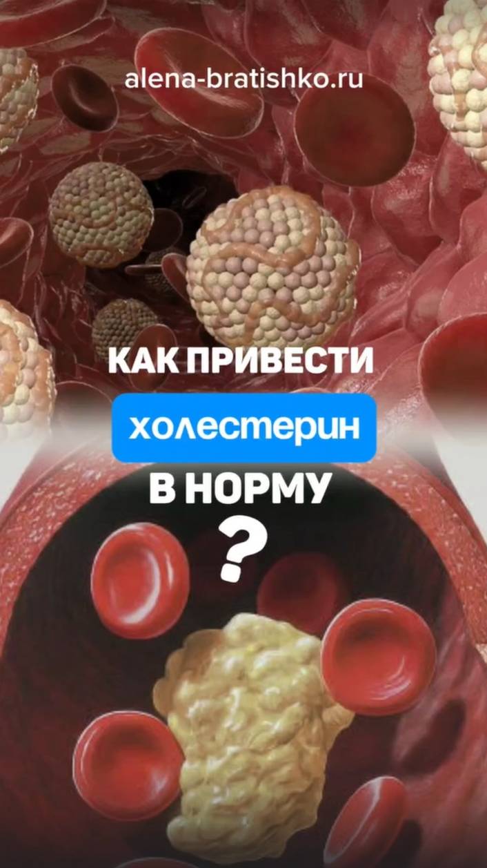 Как снизить холестерин? Алена Братишко