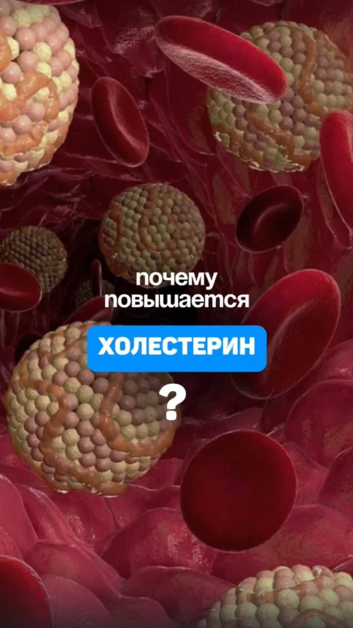 Почему холестерин повышается? Алена Братишко