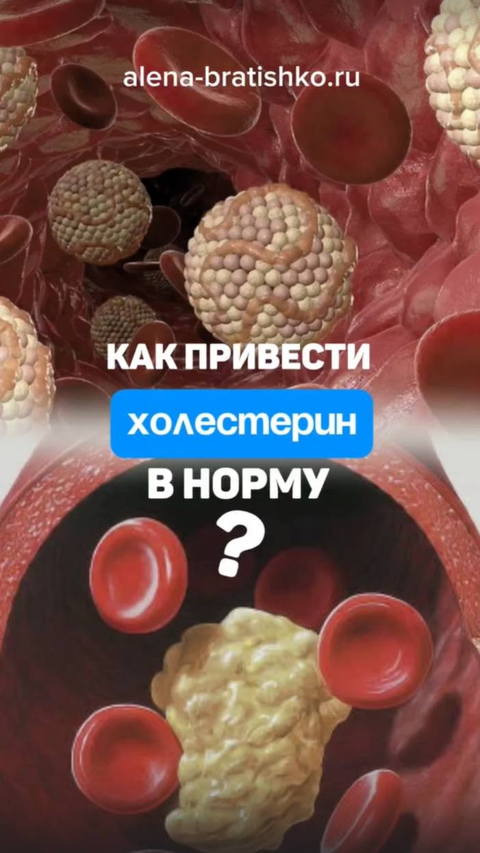 Как снизить холестерин? Что делать, чтобы привести холестерин в норму? Алена Братишко